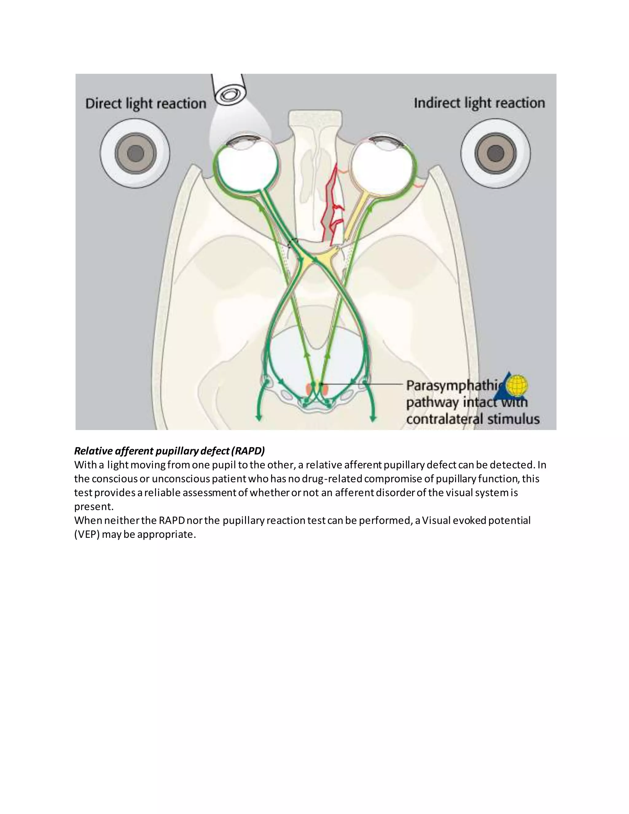 Eye examination short case | DOCX