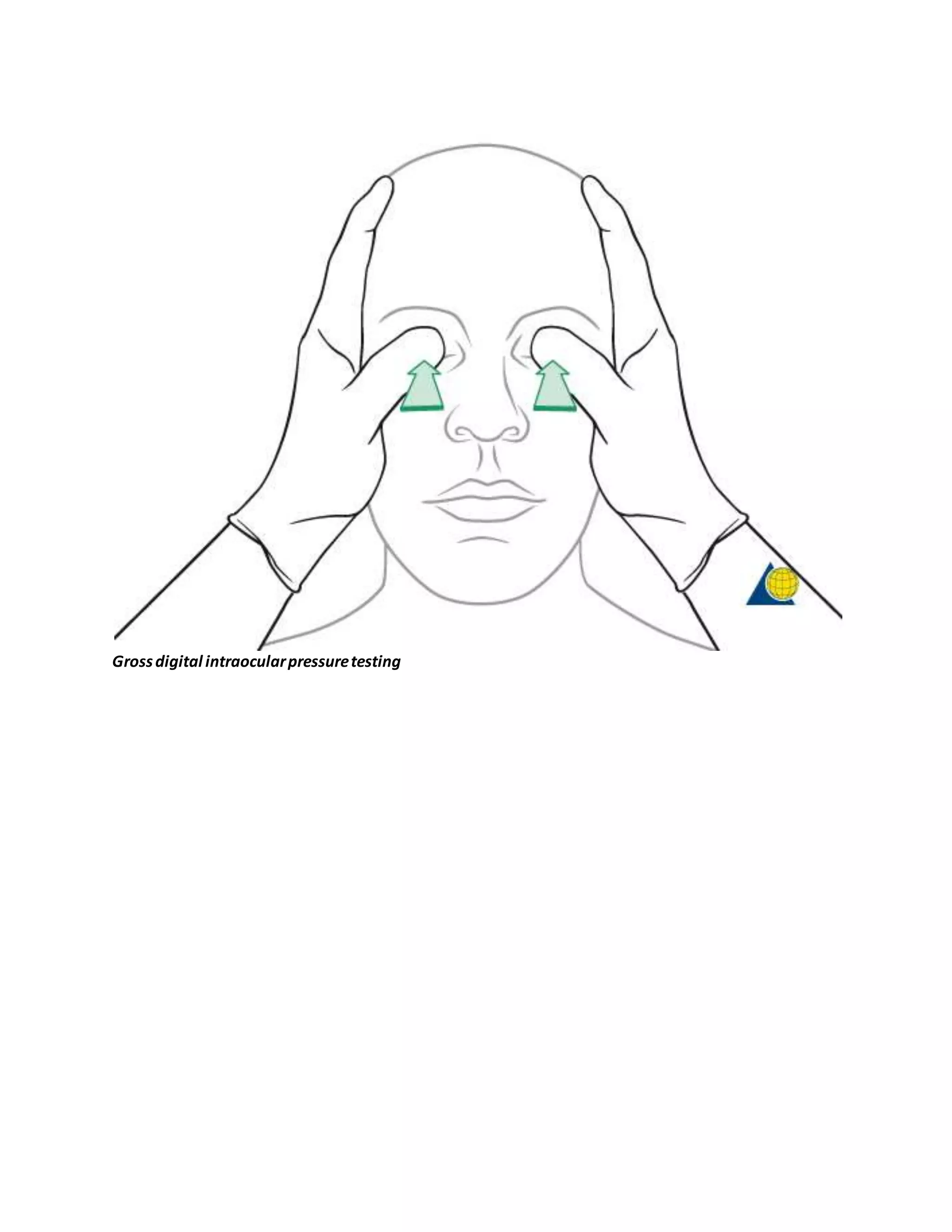Eye examination short case | DOCX