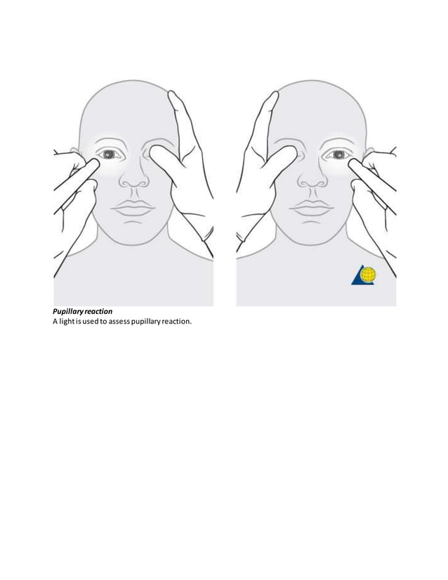 Eye examination short case | PDF