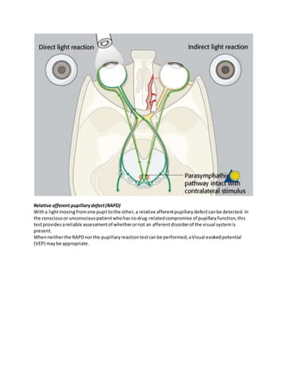 Eye examination short case | DOCX