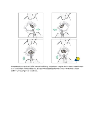 Eye examination short case | DOCX