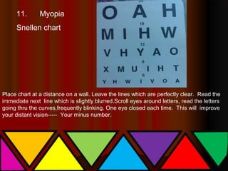 Dr. Bates Eye exercises | PPS