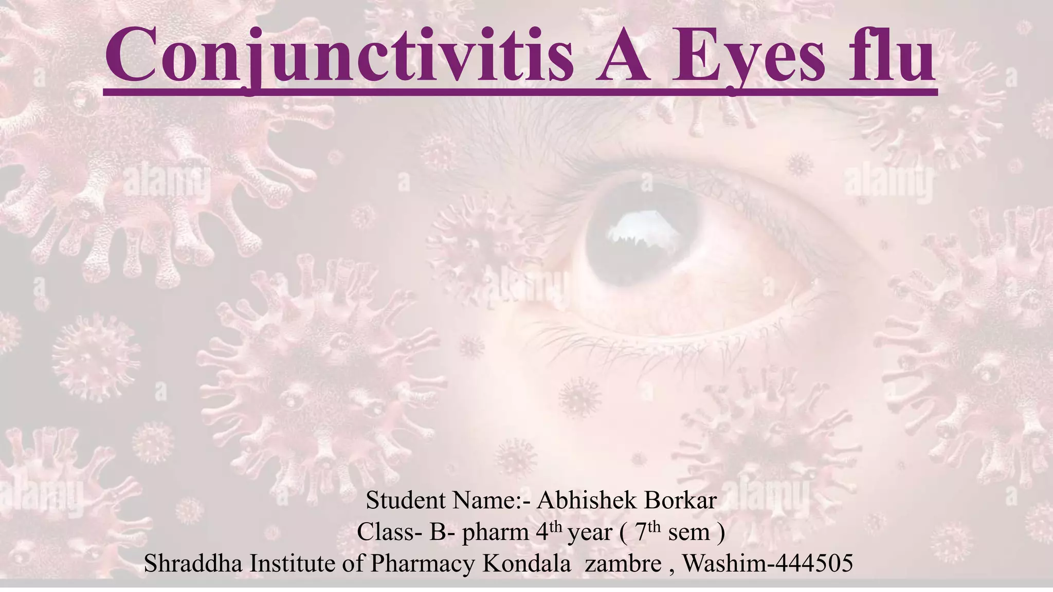Conjunctivitis eye flu..pptx
