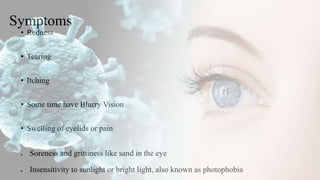 Conjunctivitis eye flu..pptx