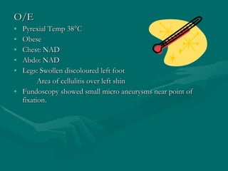 Eye-Foot Syndrome Case History | PPT | Foot Health | Diseases and ...