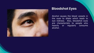 Eye Health And Alcohol: How Drinking Affects Your Eye Health? | PDF