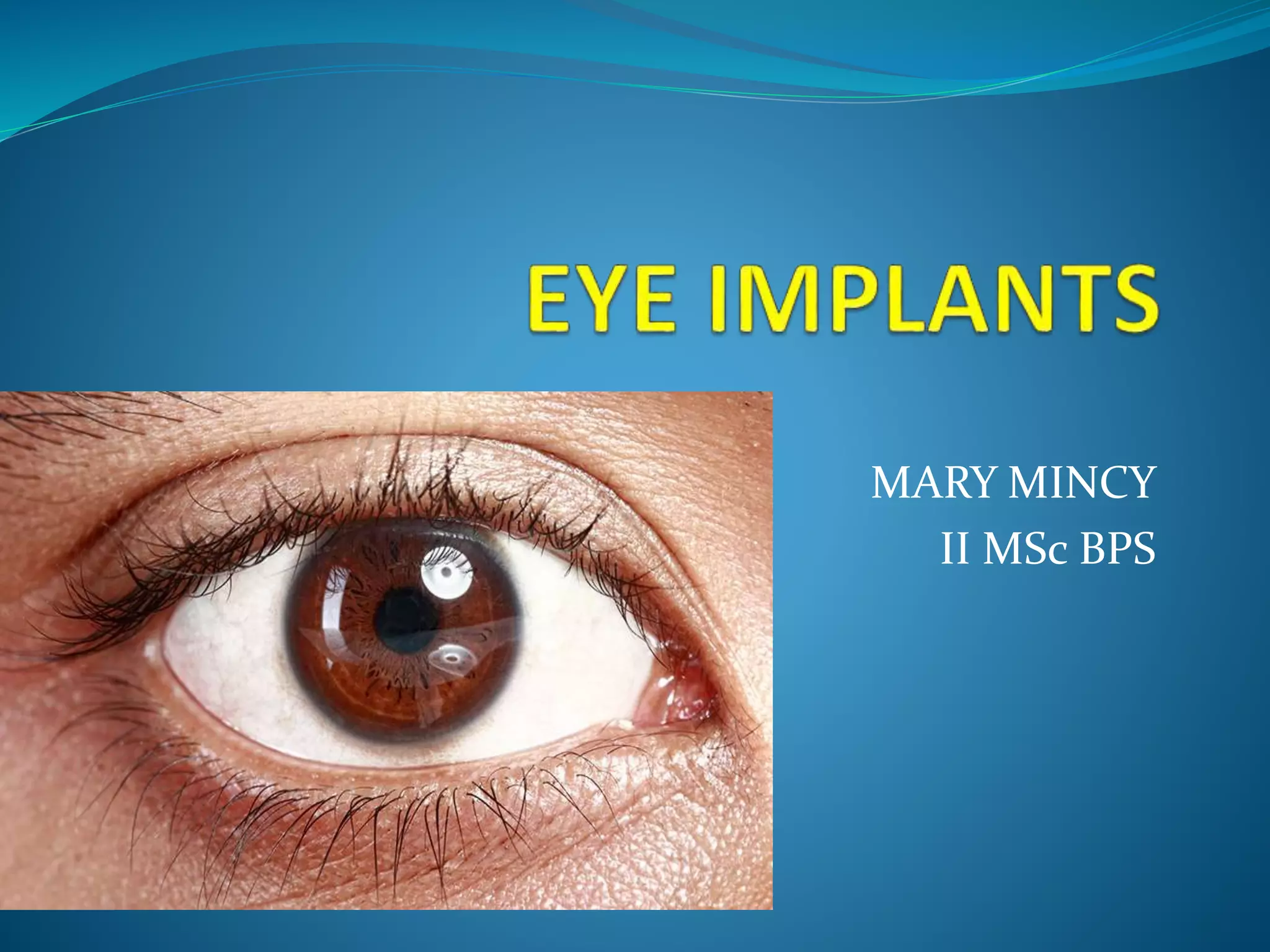 Eye implants ,tissue adhesive | PPT
