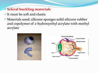 Eye implants ,tissue adhesive | PPTX