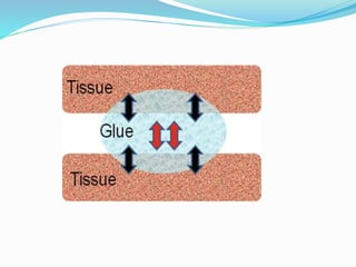 Eye implants ,tissue adhesive | PPTX