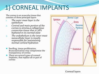 Eye implants ,tissue adhesive | PPTX
