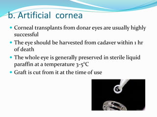 Eye implants ,tissue adhesive | PPTX