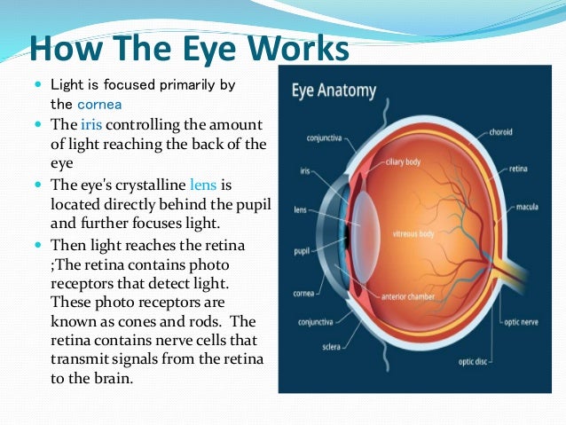 Eye implants ,tissue adhesive