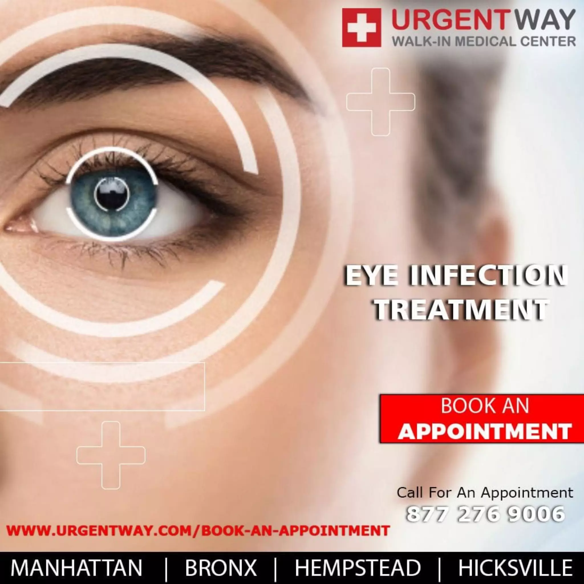 Eye Infection. | PDF