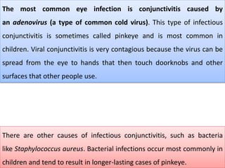 Eye infection.pptx
