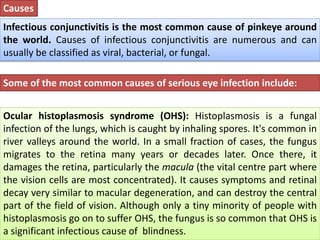 Eye infection.pptx