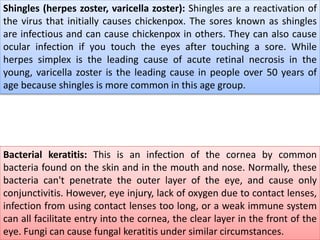 Eye infection.pptx | Infectious Diseases | Diseases and Conditions