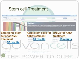 Eyeing macular degeneration with stem cells- Advancells | PPTX