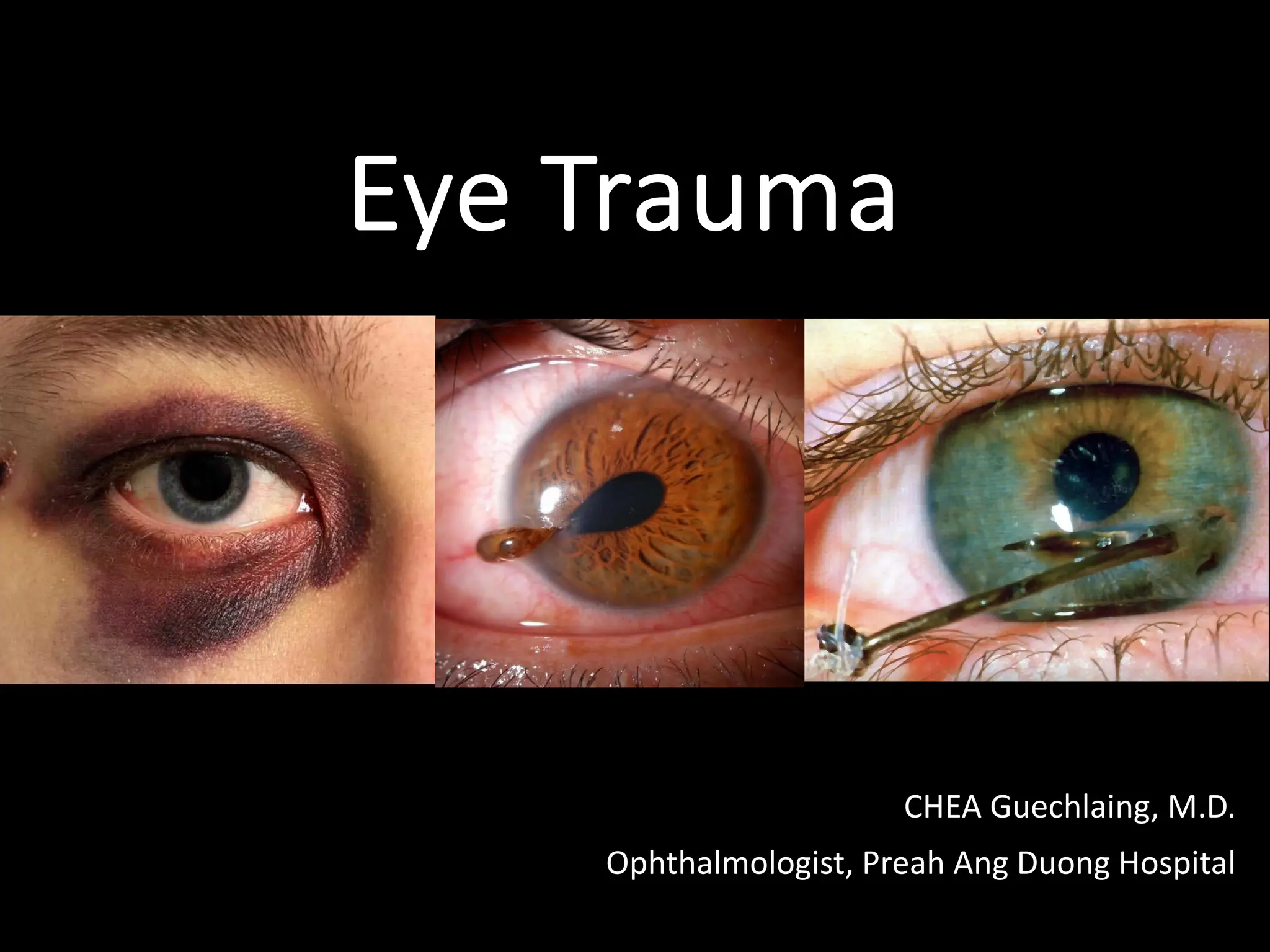 Eye injuries.pdfhhhhhhhhhhhhhhhhhhhhhhhh | PDF