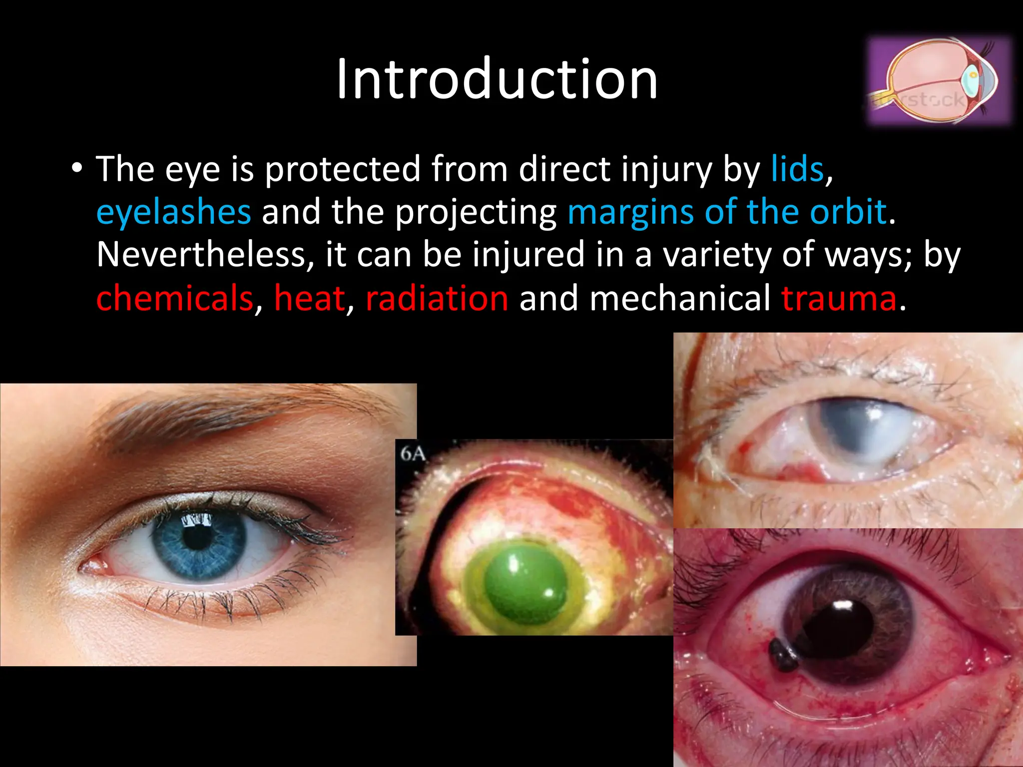 Eye injuries.pdfhhhhhhhhhhhhhhhhhhhhhhhh | PDF