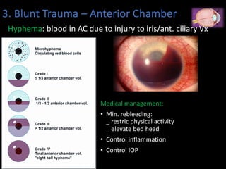 Eye injuries.pdfhhhhhhhhhhhhhhhhhhhhhhhh | PDF