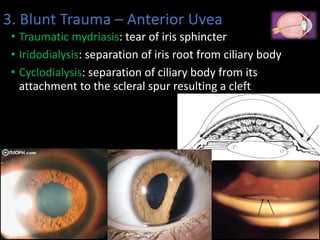 Eye injuries.pdfhhhhhhhhhhhhhhhhhhhhhhhh | PPT