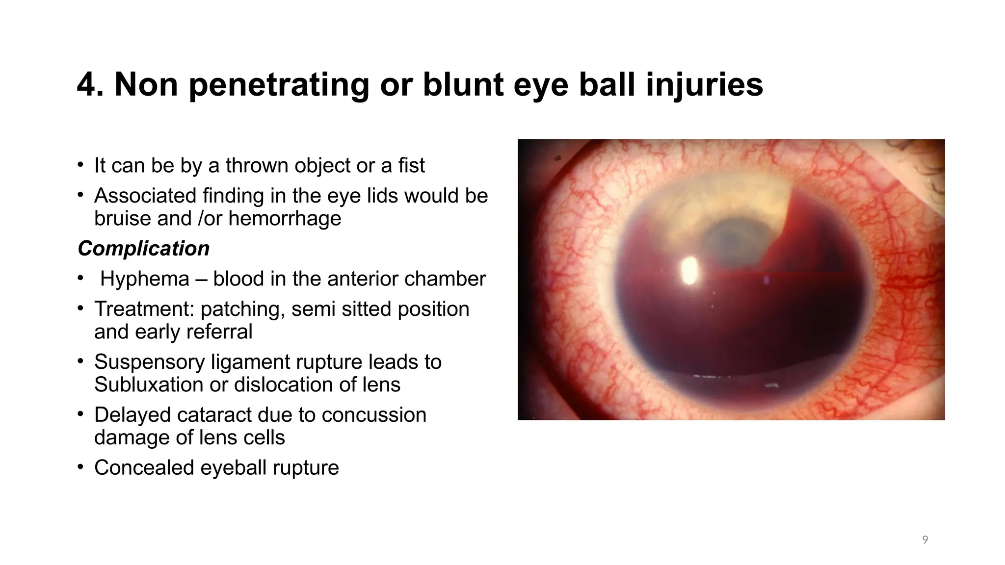 EYE INJURIES.pptxhhhhhhhgjhhjhjiyhhuyhgggf | PPTX