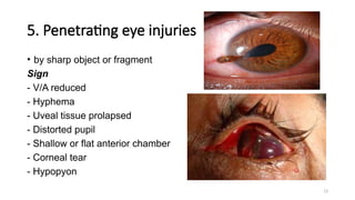 EYE INJURIES.pptxhhhhhhhgjhhjhjiyhhuyhgggf | PPTX
