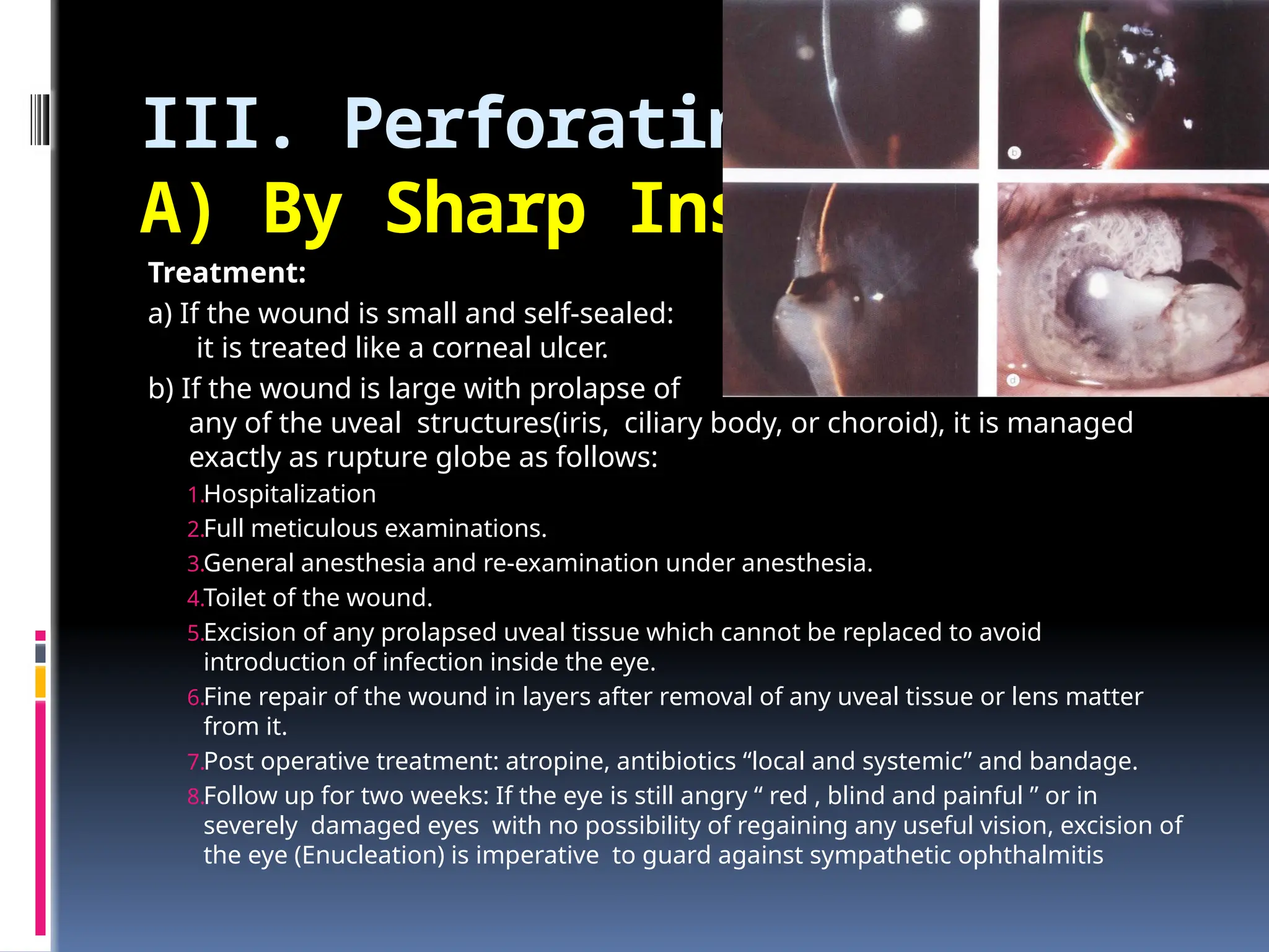 Eye Injuries6515615615616251561191956.pptx