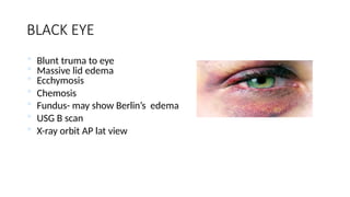 eye injuries.pptx......................... | PPTX