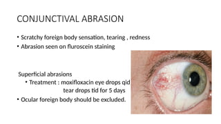 eye injuries.pptx......................... | PPTX