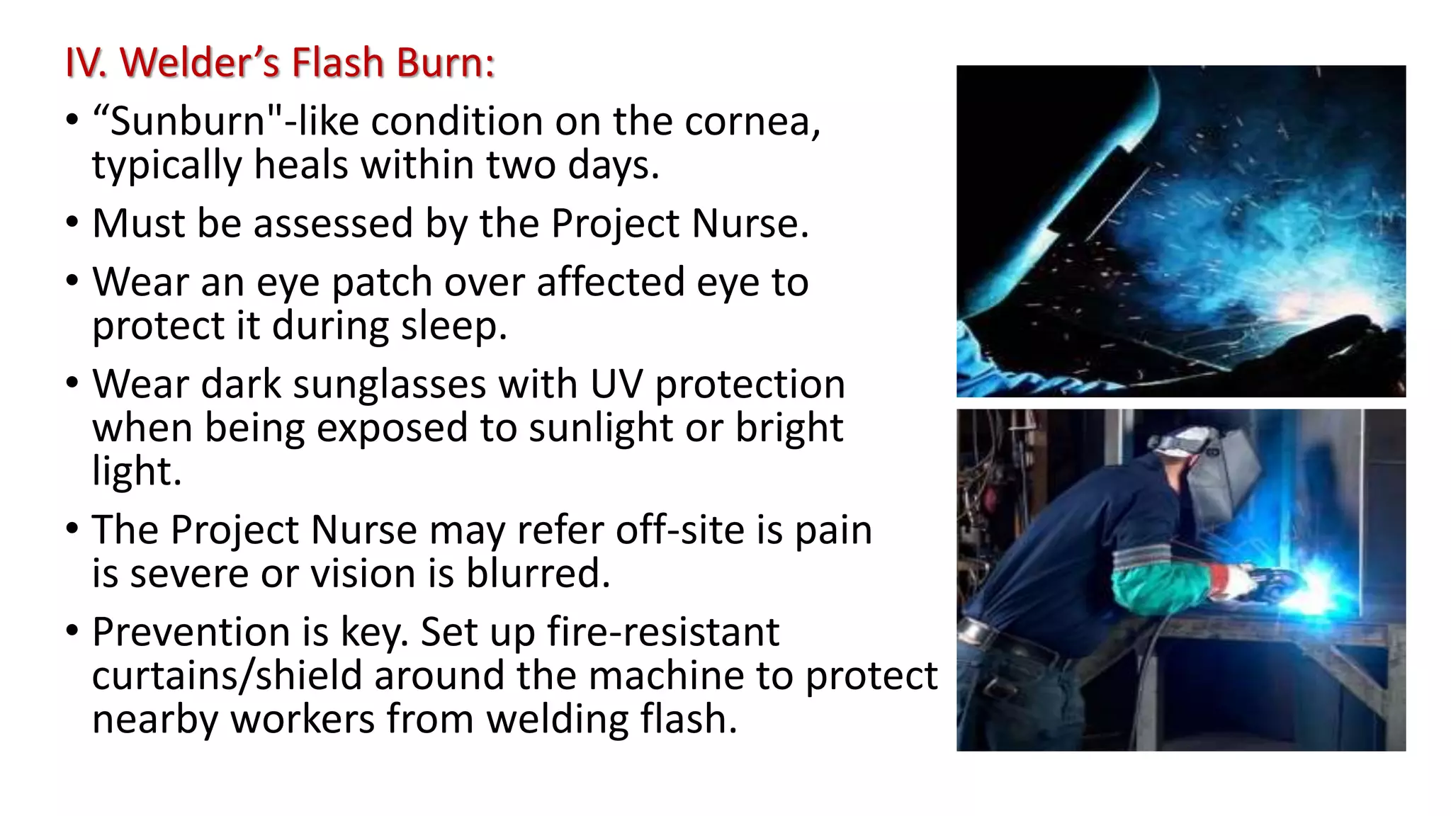 Eye injuries and first aid response | PPTX