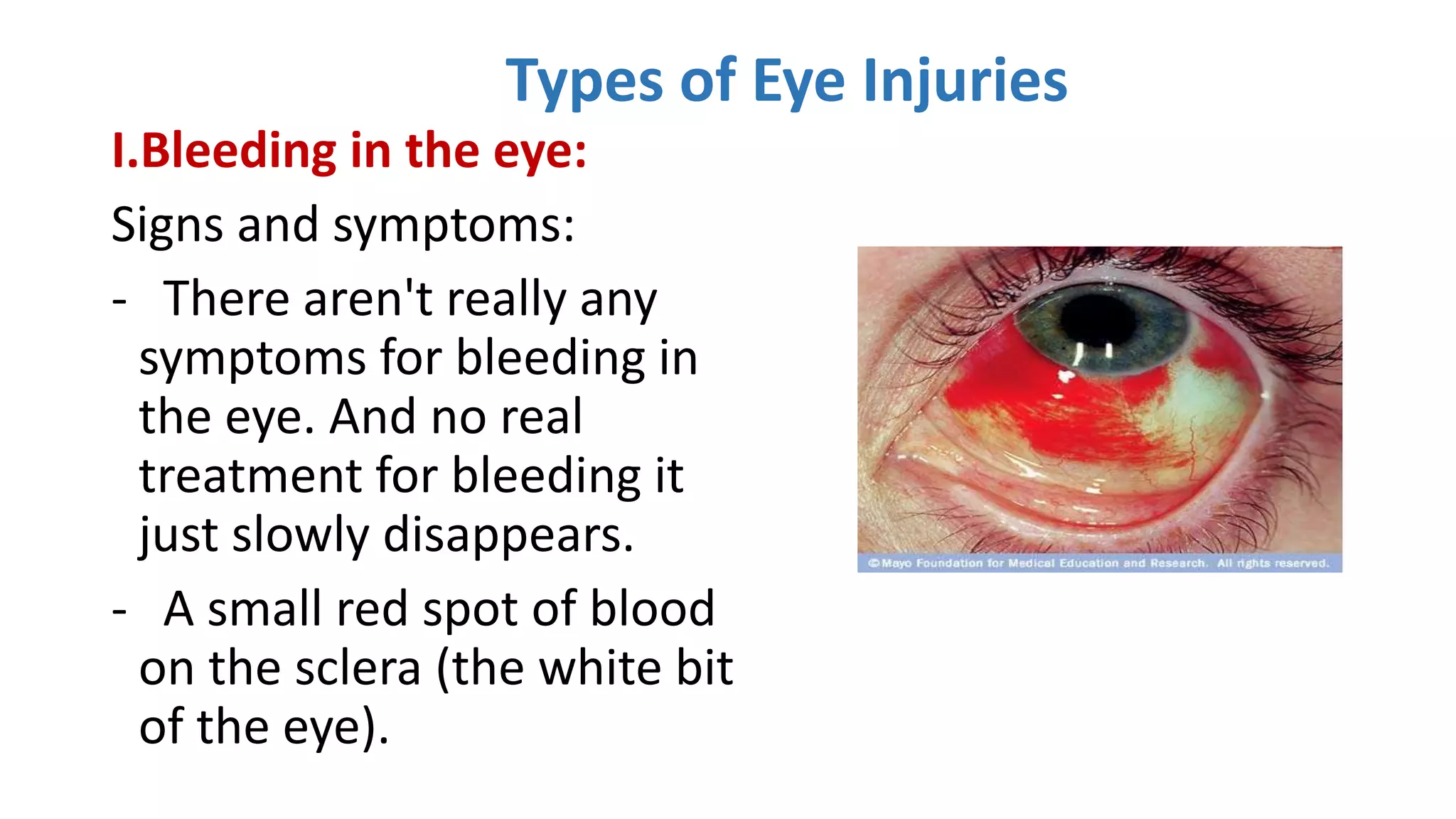 Eye injuries and first aid response | PPTX