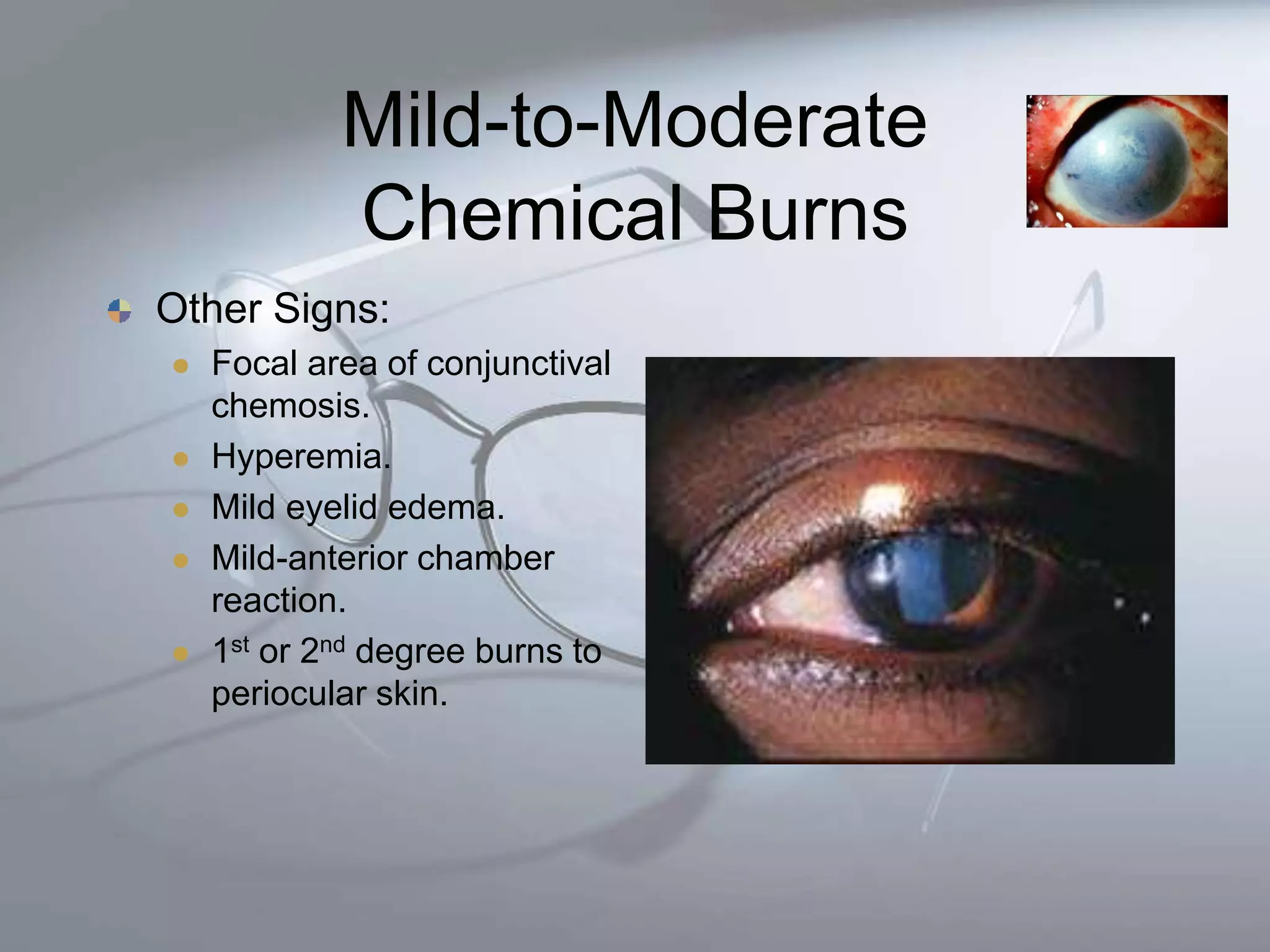 Eye injuries and illnesses- Third year mbbs Ophthalmology | PPTX
