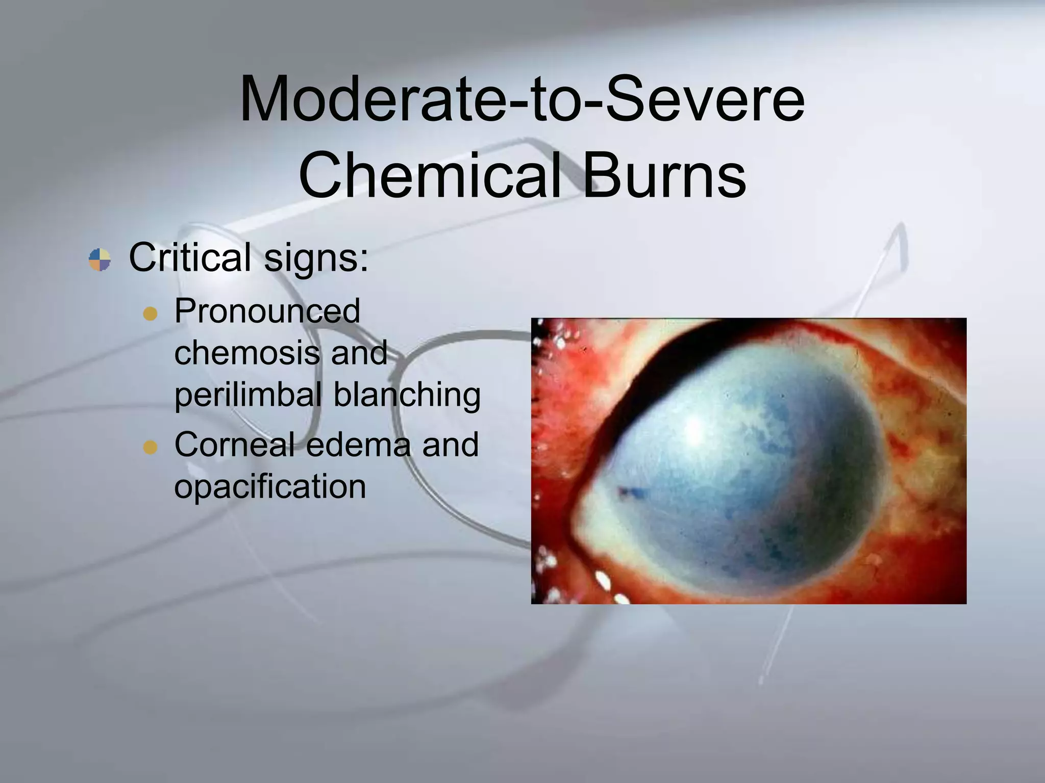 Eye injuries and illnesses- Third year mbbs Ophthalmology | PPTX