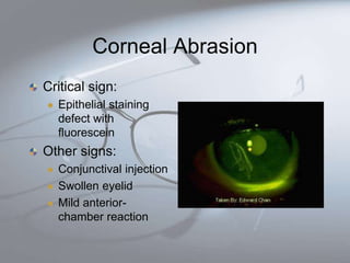 Eye injuries and illnesses- Third year mbbs Ophthalmology | PPTX