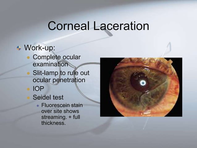 Eye injuries and illnesses- Third year mbbs Ophthalmology | PPTX | Eye ...