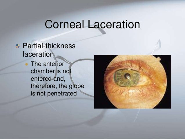 Eye injuries and illnesses- Third year mbbs Ophthalmology