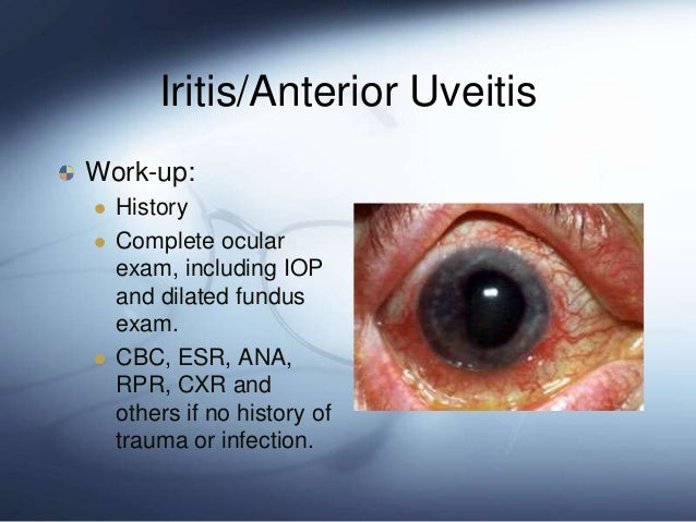 Eye injuries and illnesses- Third year mbbs Ophthalmology