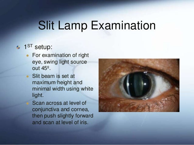 Eye injuries and illnesses- Third year mbbs Ophthalmology