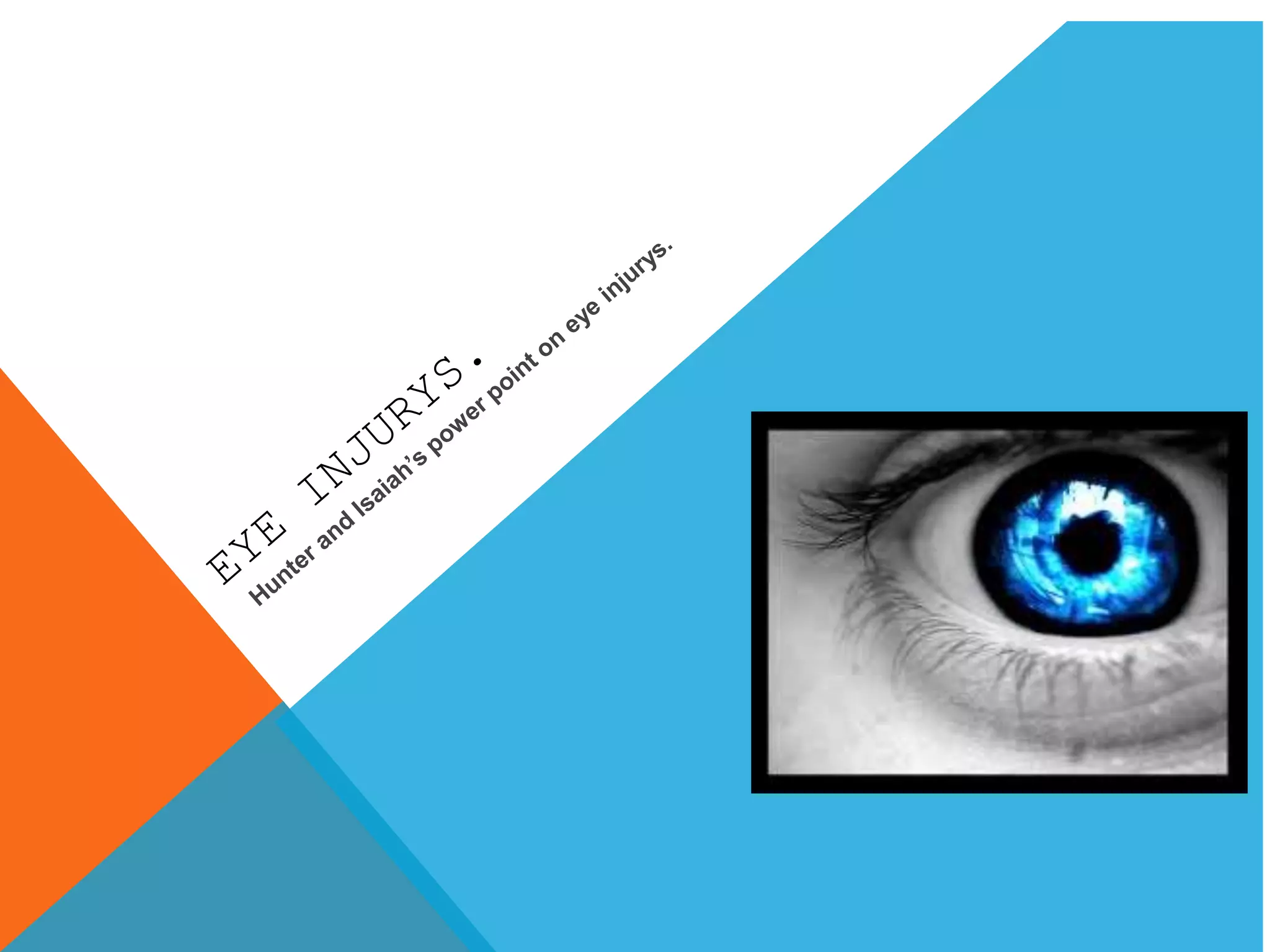 Eye injurys | PPTX