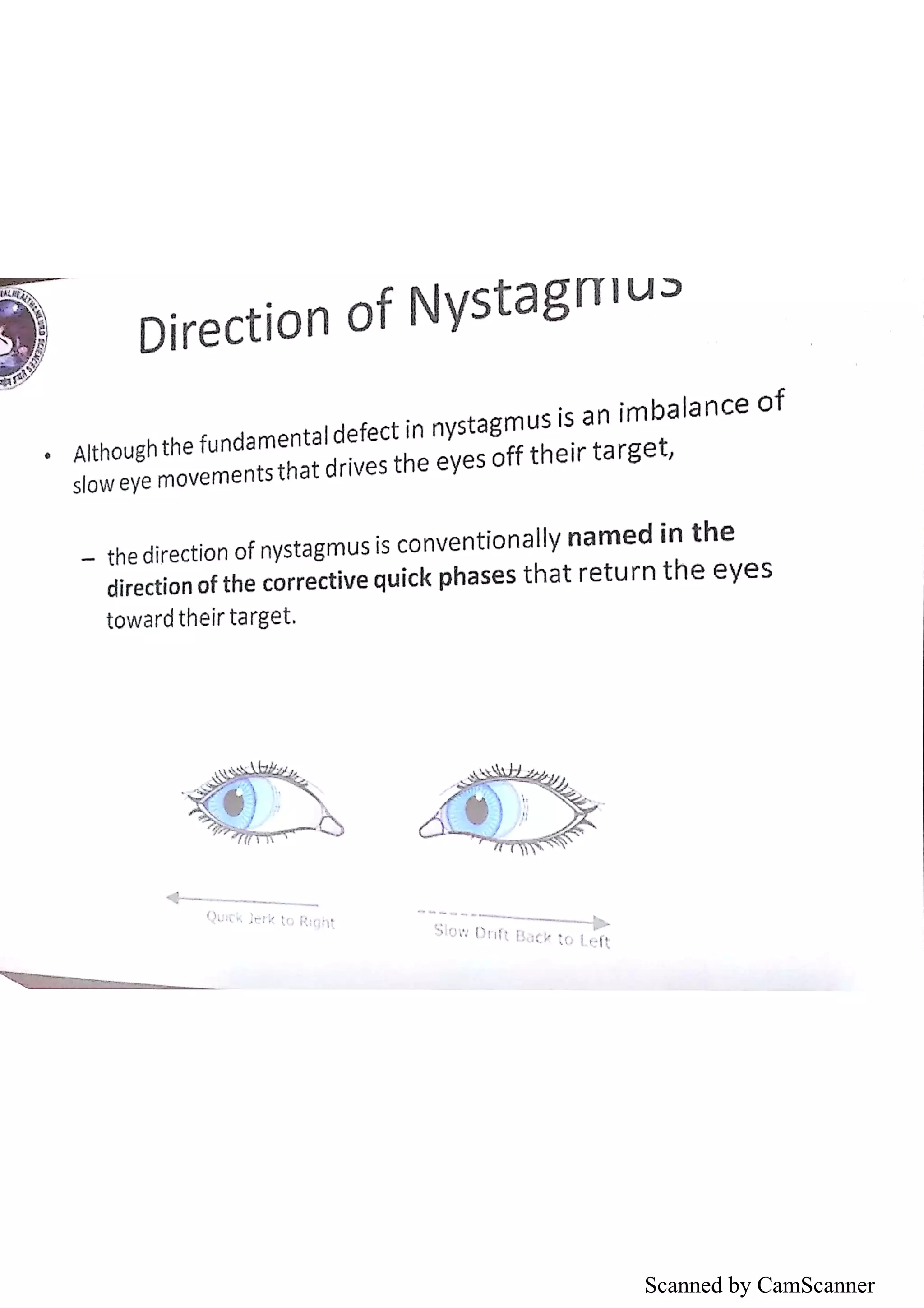 Eye movements in neurological examination : Nystagmus | PDF