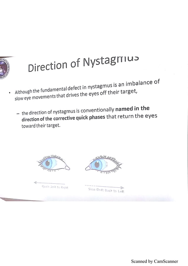 Eye movements in neurological examination : Nystagmus | PDF