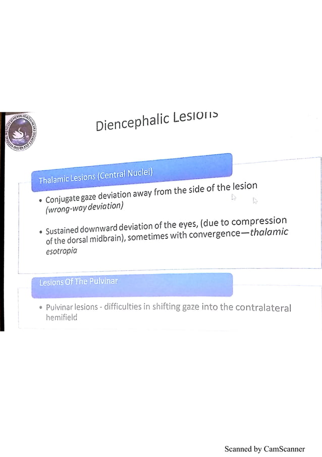 Eye movements in neurological examination : Nystagmus | PDF