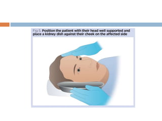 Eye irrigation | PPTX