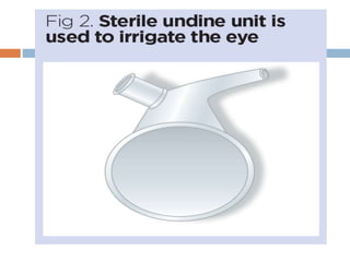 Eye irrigation | PPTX