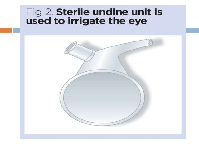 Eye irrigation | PPTX