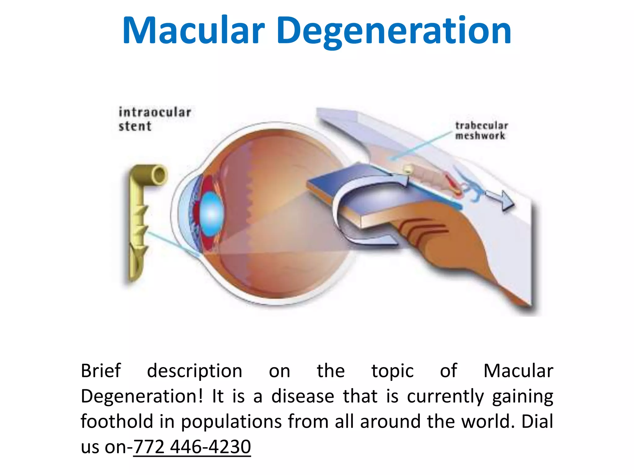 Routine Eye Exam | PPTX | Eye and Vision Conditions | Diseases and ...