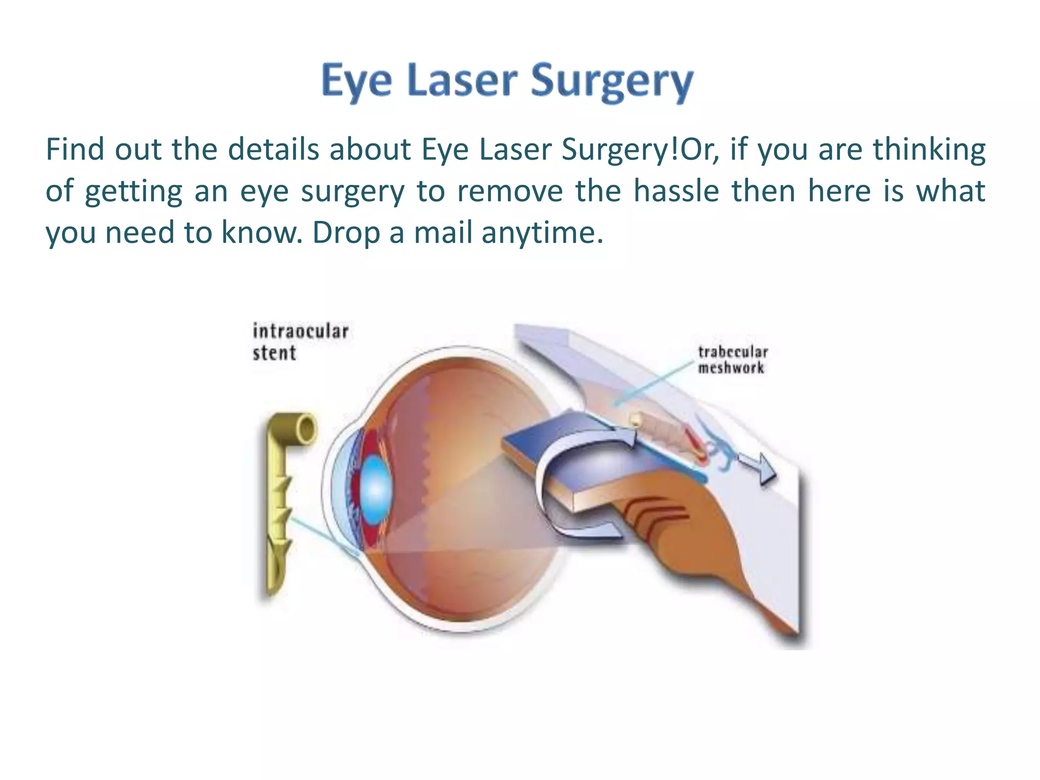 Routine Eye Exam | PPTX