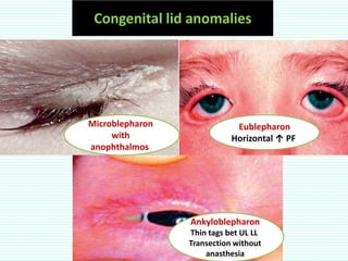 Eye lid | PPT