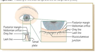 EYE LID. Diseases and anatomy for undergraduate | PPTX